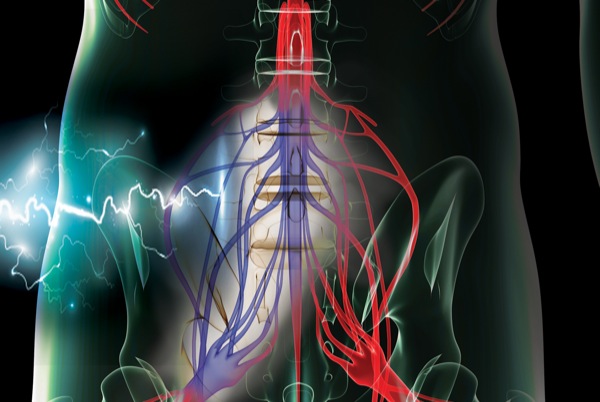 Peripheral Nerve Field Stimulation Found Effective in Alleviating ...