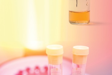 Platelet Lysate Epidural Injections Effectively Treat Lumbar Radicular Pain