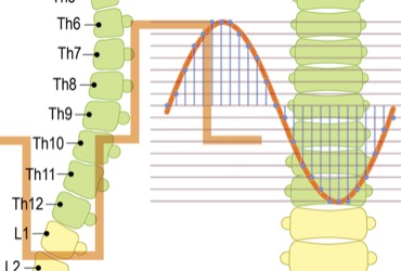 Study Finds High-Frequency SCS Effective In Reducing Opioid Dose for ...