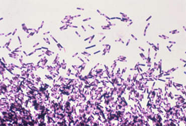 Risk Modeling Study Shows No Link Between NSAIDs and C. diff Infection