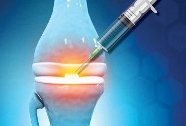 Only Short-Term Difference Seen in Knee OA Injections