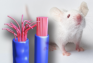 Insight Into the Pathophysiologic Mechanisms of Neuropathic Pain