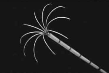 Multi-tined Radiofrequency Electrode Shows Advantages in Treating Multi ...