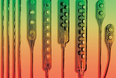 Neurologic Injuries Rare With Paddle-Lead SCS