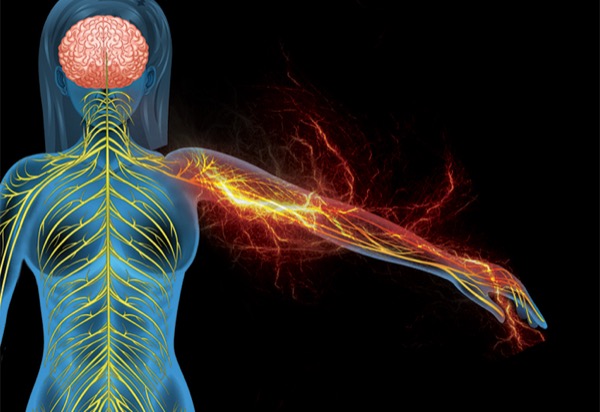 New Diagnostic CRPS Guidelines Highlight Chronic Presentation